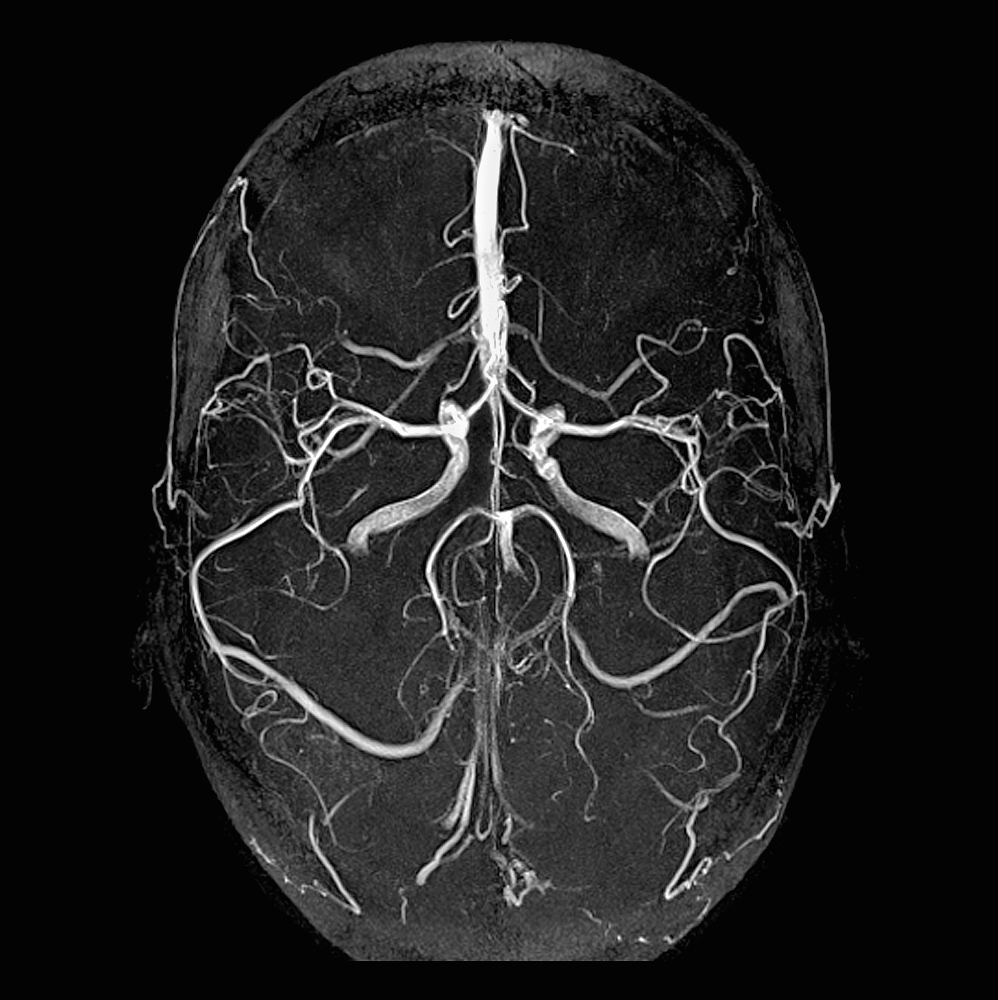 VBS Imaging LLC | MRI, Ultrasound & X-ray in Calabasas